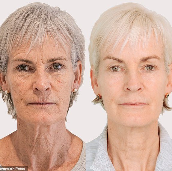 Judy Murray's Transformation: Get It At Medizen